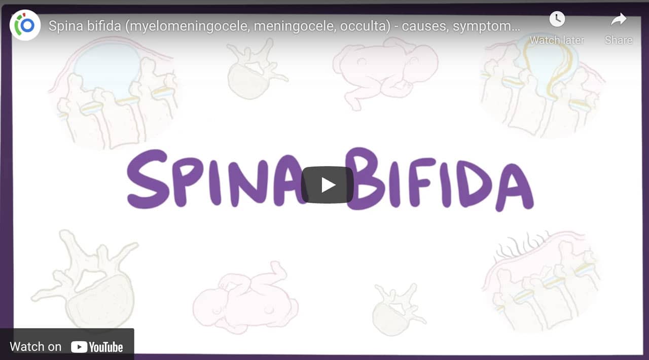 Spina Bifida Video English 1 Caring Professionals Home Care And Cdpap
